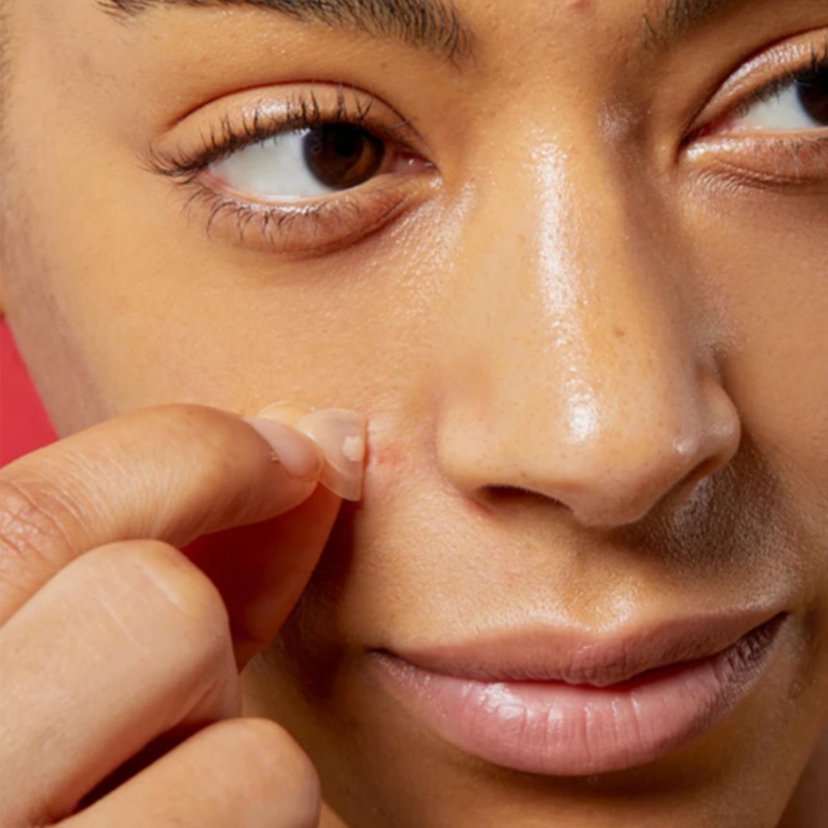 Weg met die puisten! Zo werken pimple patches | lyko.com