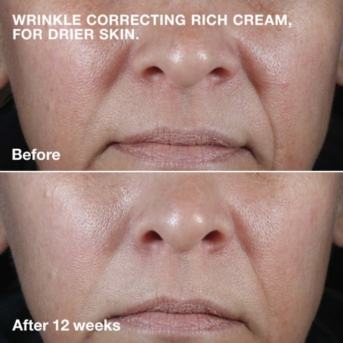 Clinique Smart Clinical Repair Wrinkle Face Cream Rich | lyko.com
