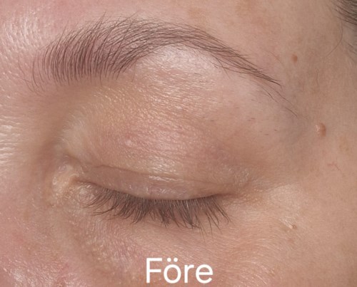 Xlash Sensitive Eyelash Serum 3 ml | lyko.com