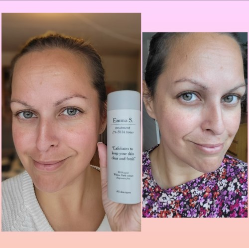 Emma S. Treatment 2 % BHA Toner | lyko.com