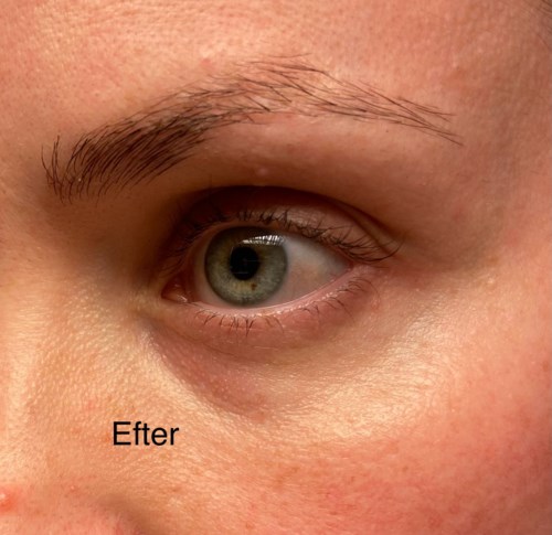 Biotherm Blue Therapy Blue Pro-Retinol Moisturizing Eye Cream 15 ml ...